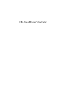 MRI atlas of human white matter by Mori, Susumu (9780080456164 ...