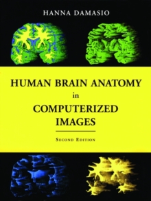 Human Brain Anatomy in Computerized Images by Damasio, Hanna ...