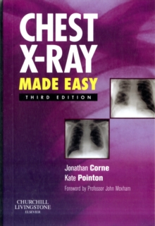 Chest X-Ray Made Easy by Corne, Jonathan (Consultant Respiratory ...
