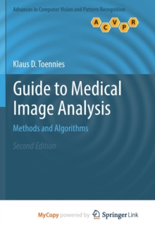 Guide to Medical Image Analysis by Toennies, Klaus D. (9781447173199 ...