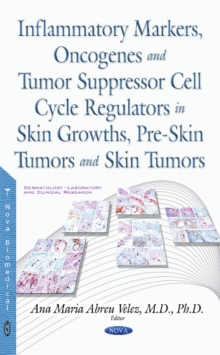 Inflammatory Markers, Oncogenes, Tumor Suppressor Cell Cycle Regulators ...